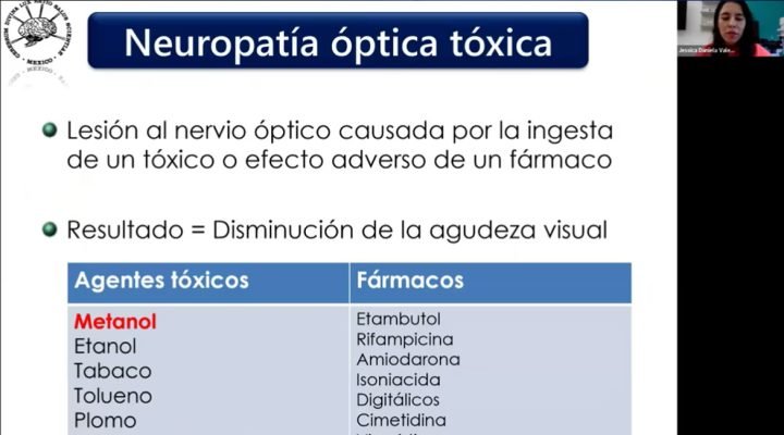 Diagnóstico neuropatía óptica tóxica – Asociación Mexicana