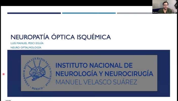 Neuropatía óptica isquémica – Asociación Mexicana